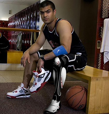 10 Stunning Prosthetics Made by an Industrial Designer - TechEBlog